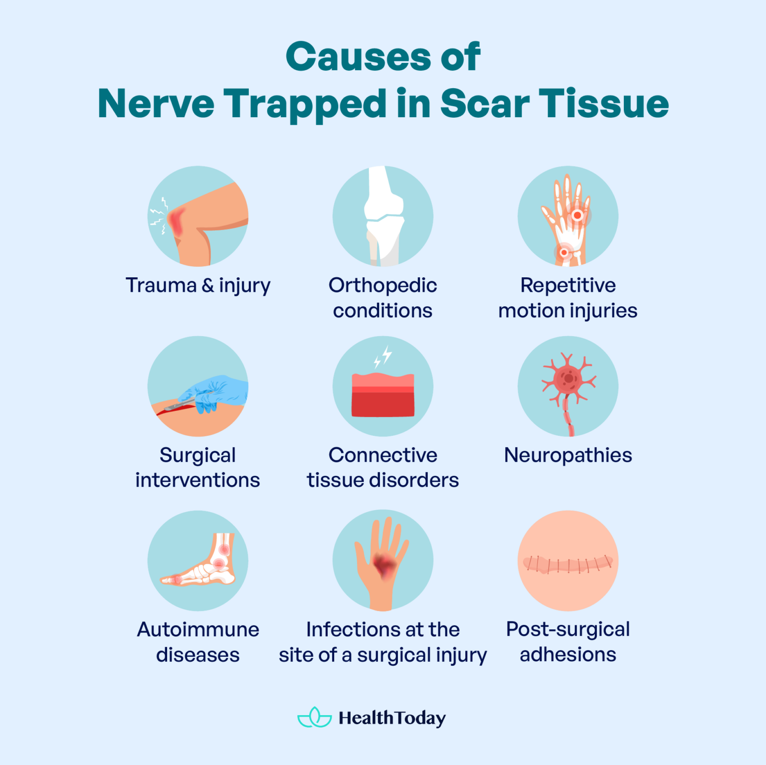 Nerve Trapped in Scar Tissue: Causes, Treatment, and Care