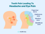 Toothache Causing Headache and Eye Pain | Hidden Links