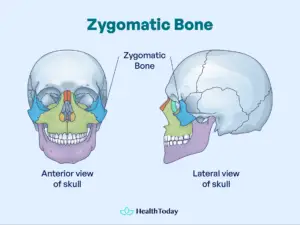 Zygomatic Bone Pain: Causes and Home Remedies