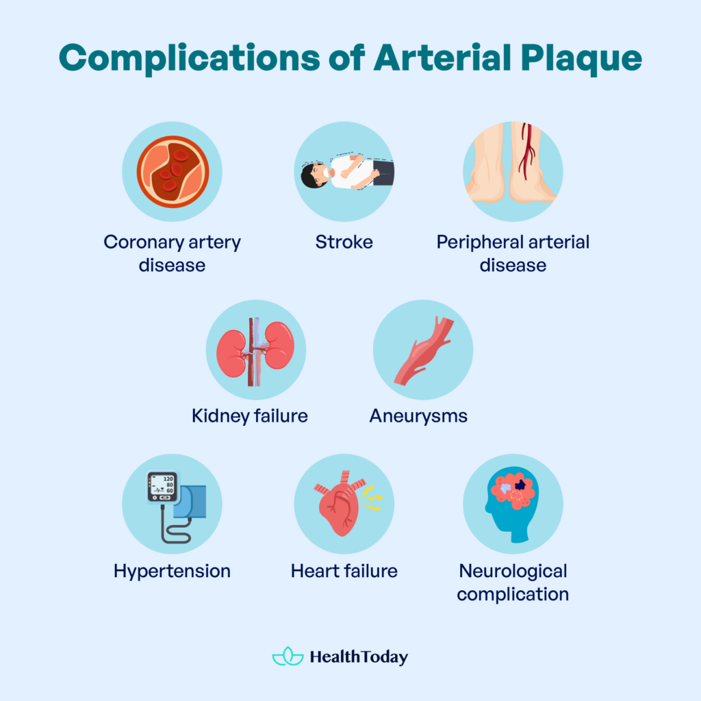 How to Reduce Plaque in Arteries? Vascular Cleansing Naturally