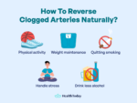 How to Reduce Plaque in Arteries? Vascular Cleansing Naturally