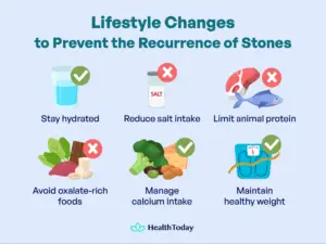 Do Kidney Stones Cause Back Pain? Signs To Tell - HealthToday