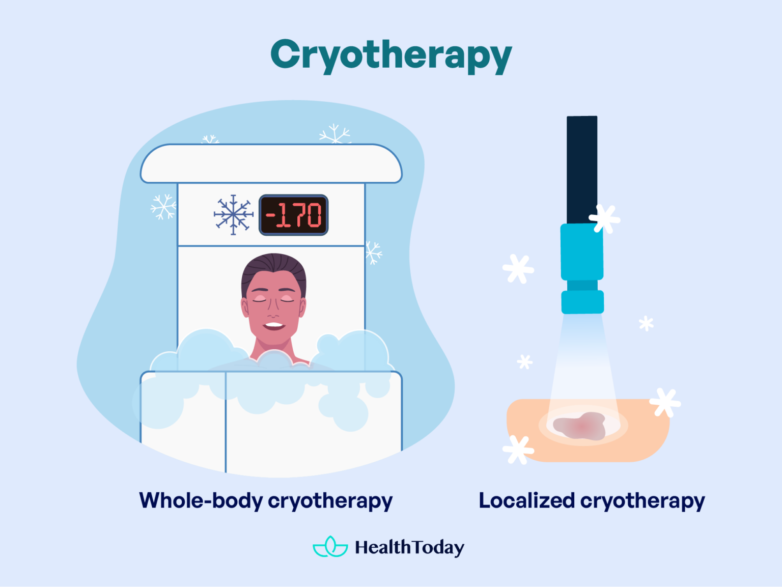 How Often Can You Do Cryotherapy? Weight Loss and Beyond - HealthToday