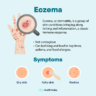 Is Eczema an Autoimmune Disease? What You Should Know - HealthToday
