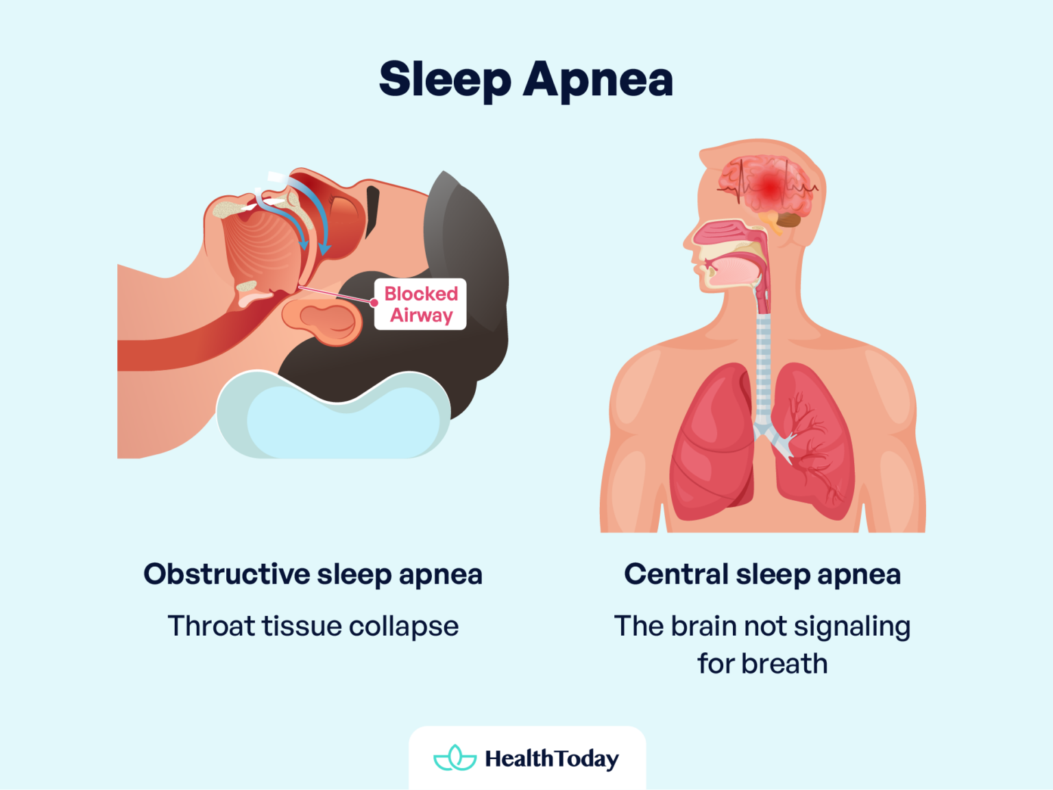 Shallow Breathing While Sleeping: Dyspnea vs. Apnea - HealthToday