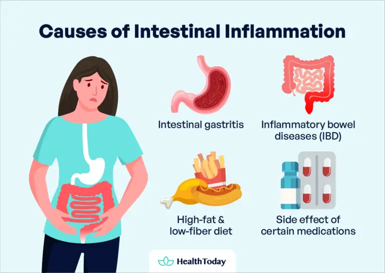 How To Calm Inflamed Intestines? Explore The Causes, Symptoms, and ...