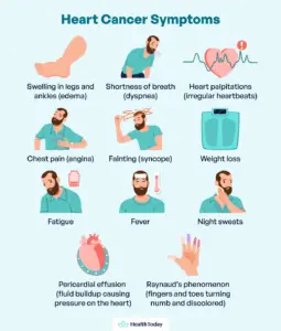 Is There Heart Cancer? Types, Symptoms, Treatments - HealthToday