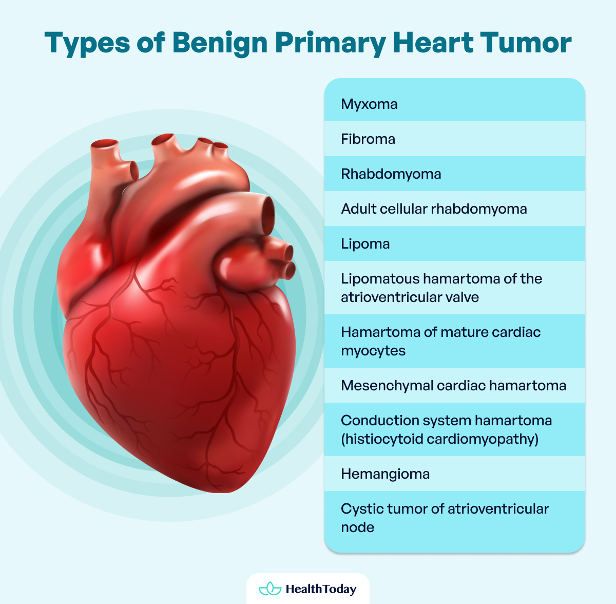 Is There Heart Cancer? Types, Symptoms, Treatments - HealthToday