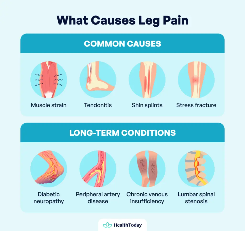 What Helps With Leg Pain: Quick Relief, Home Remedies, and More ...