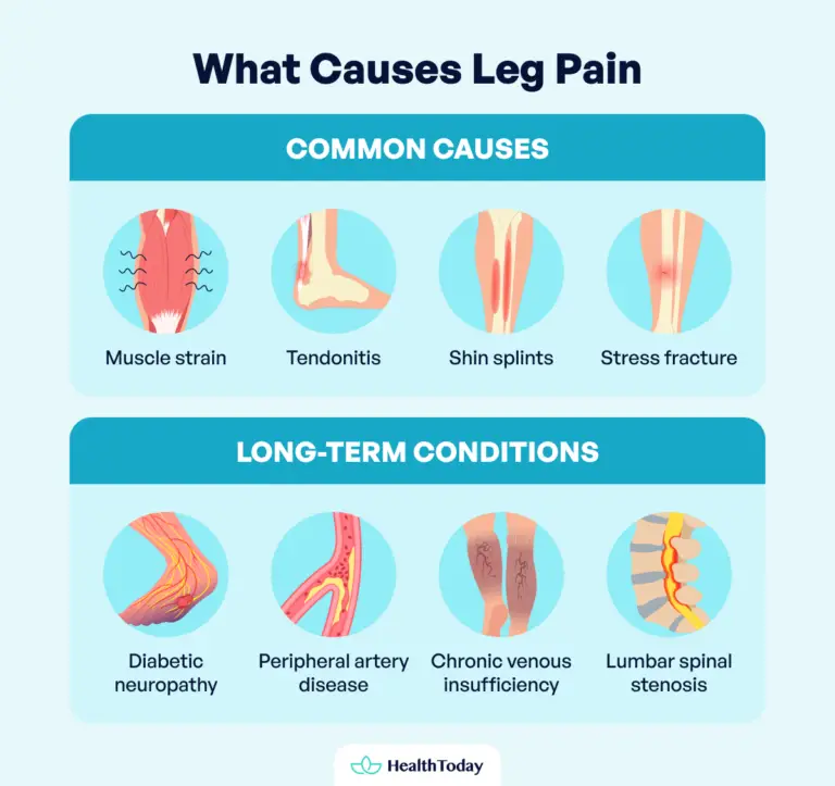 What Helps With Leg Pain: Quick Relief, Home Remedies, and More ...