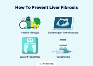 What Is Liver Fibrosis: Causes, Symptoms, Stages and More - HealthToday