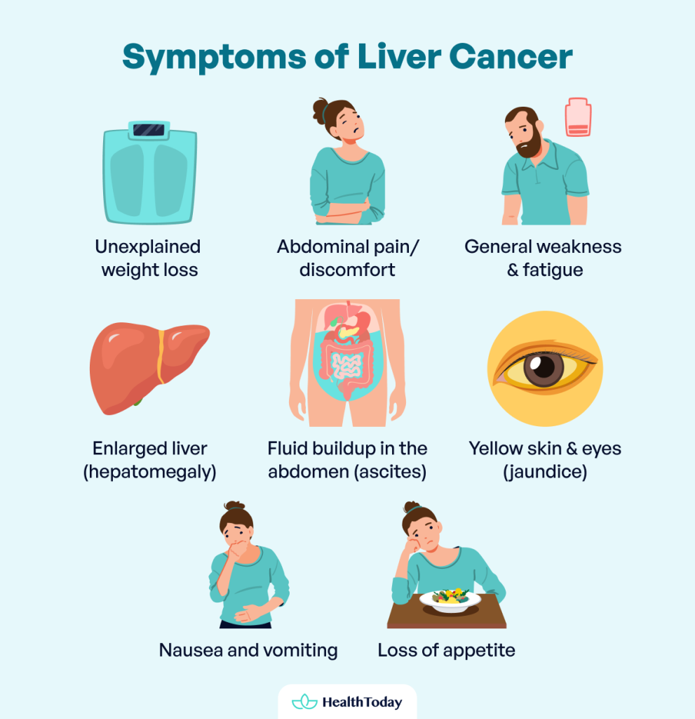 New Screening Tool May Improve Liver Cancer Survival Rates up to 90% ...